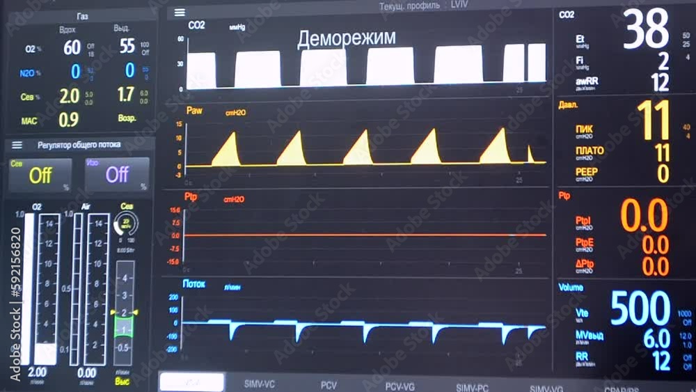 Modern patient monitor. Electronic Health Monitor displaying medical ...