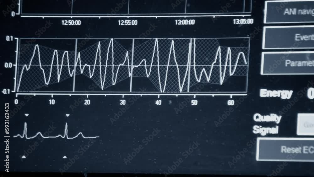 Modern patient monitor. Electronic Health Monitor displaying medical ...