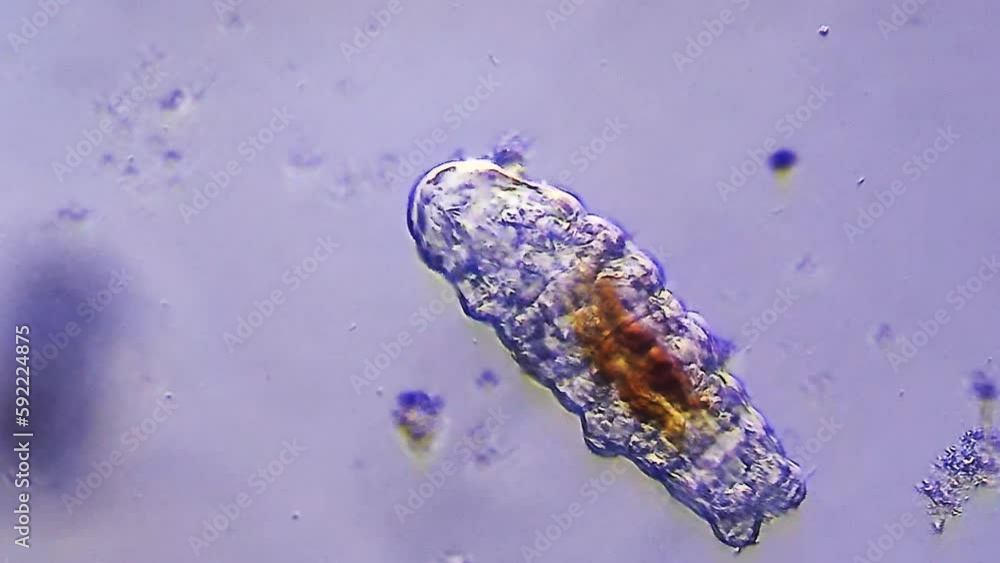 Tardigrade microorganism viewed under microscope Stock Video | Adobe Stock