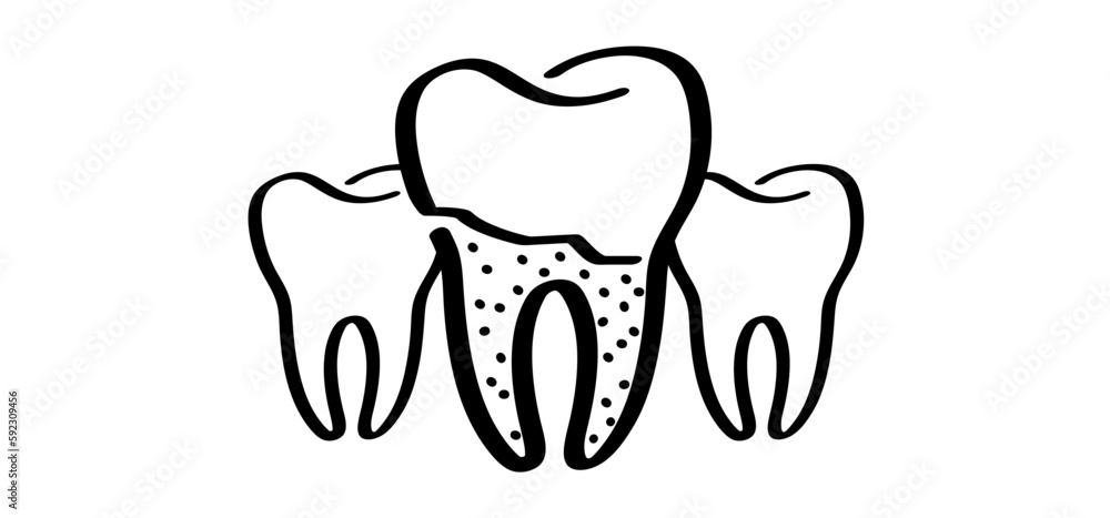 Cartoon healthy, tooth with gums, line pattern. Vector drawing ...