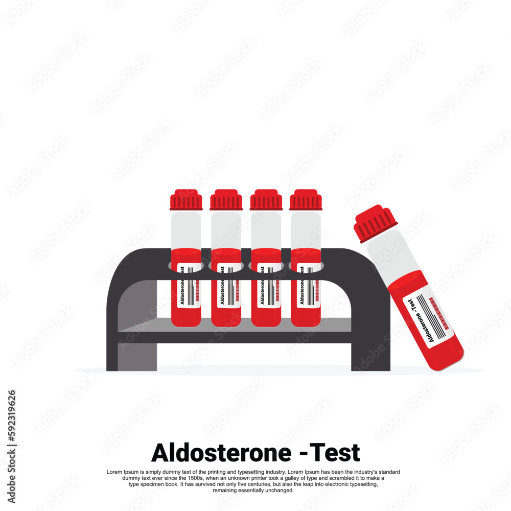 Blood sample for Aldosterone hormone test. Medical test tube in ...