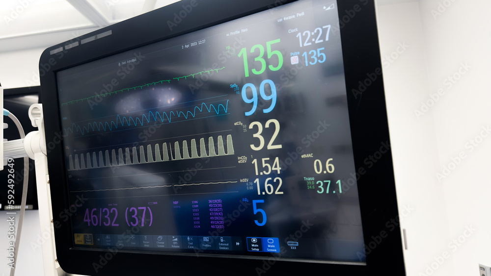 hospital anesthesia machine with attached medical equipment such as ...