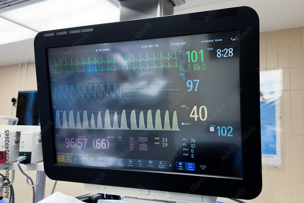 hospital anesthesia machine with attached medical equipment such as ...