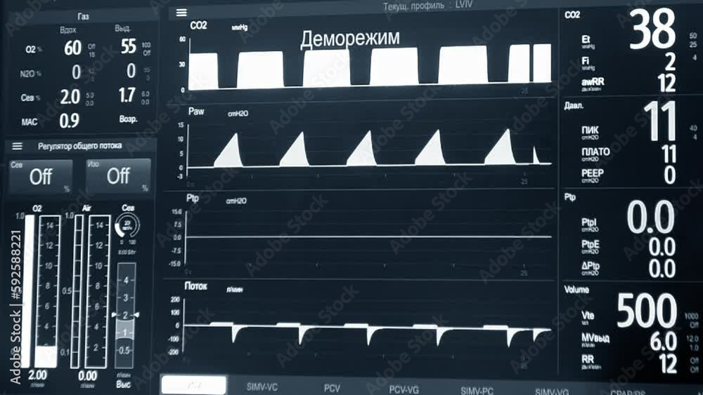 Patient monitor close-up. Monitor with different patient vital signs in ...