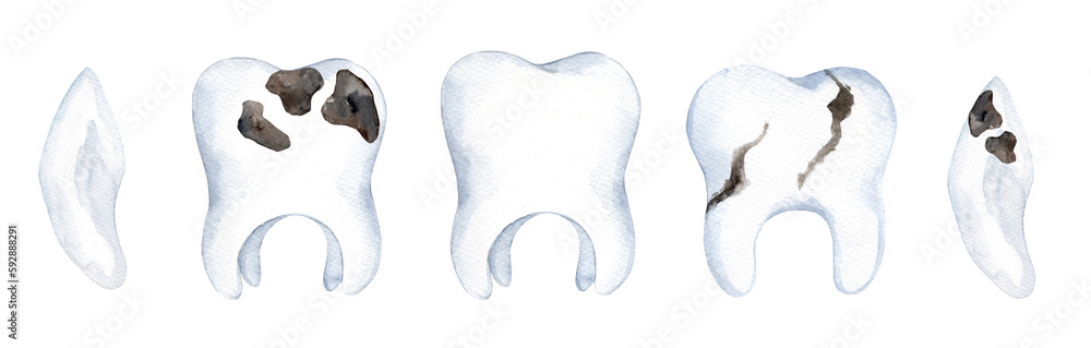 Set of human teeth with various injuries. Healthy and diseased tooth ...