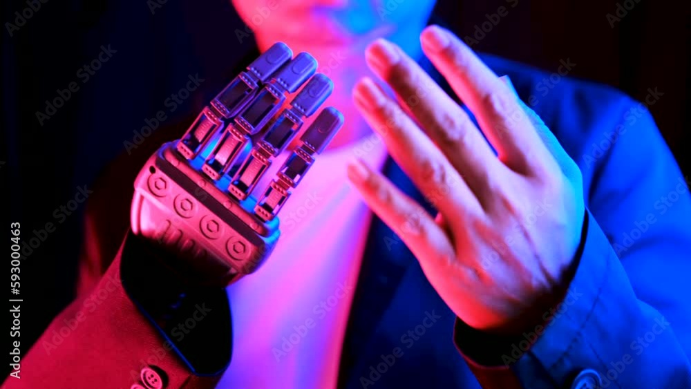 man's prosthetic hand and arm, who's lost one in an accident or war ...