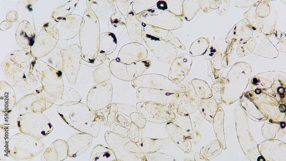 Microscopic view of a banana starch granule in banana pulp cells ...