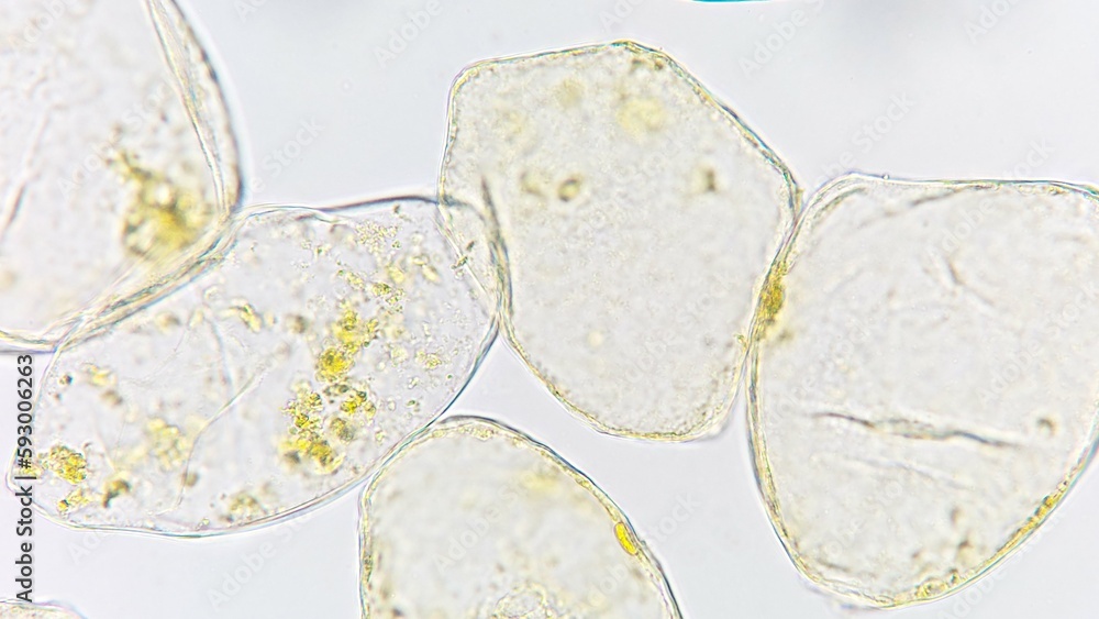 Microscopic view of a banana pulp cells. Stained by lugol iodine ...