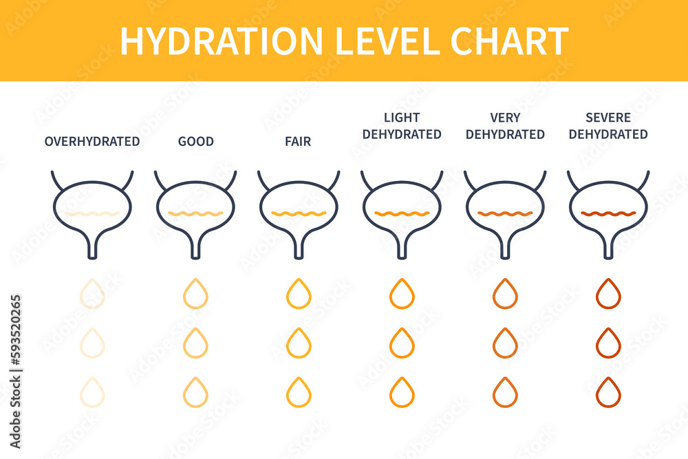 Urine color chart diagram. Bladders with urine showing different ...