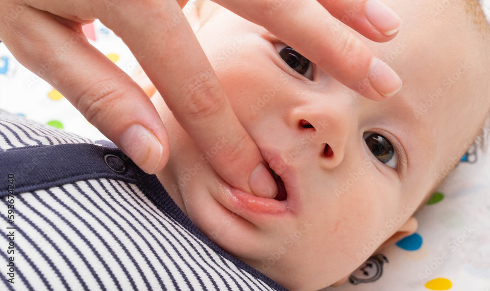 A mother massages the gums of a baby boy during the eruption of the ...
