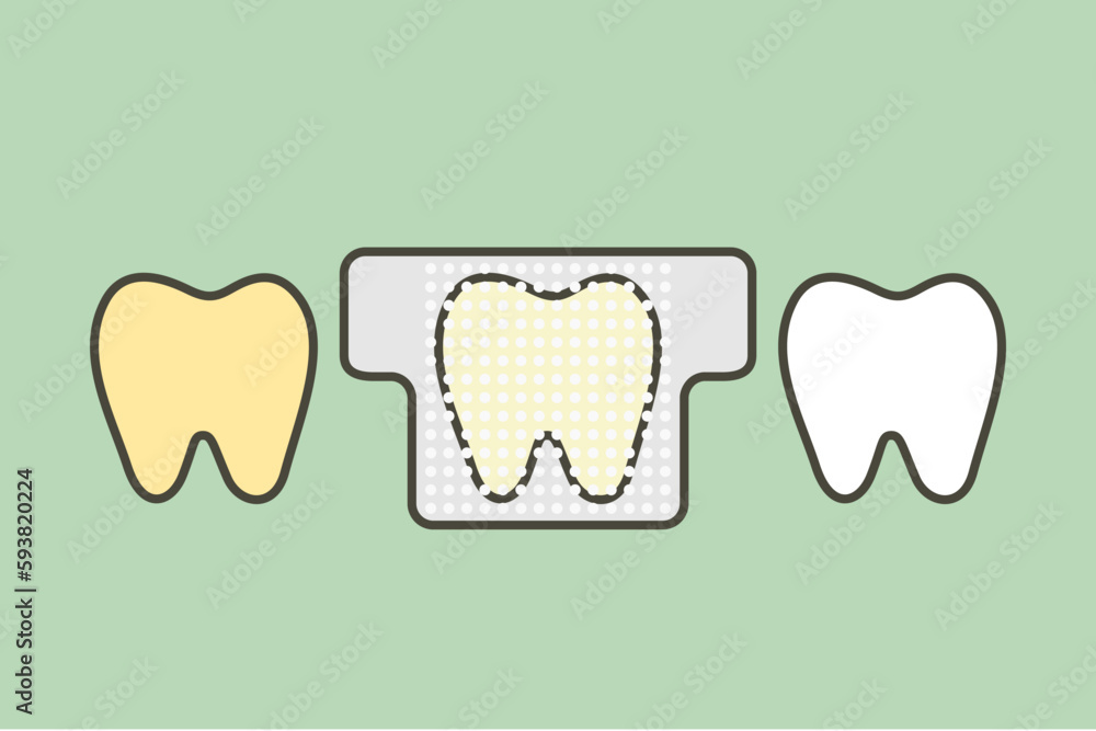 tooth whitening, yellow tooth used teeth whitening strip to whiten ...