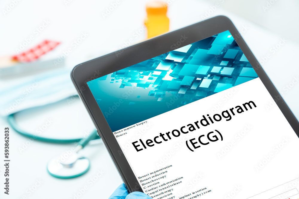Electrocardiogram (ECG) medical procedures A procedure that records the ...