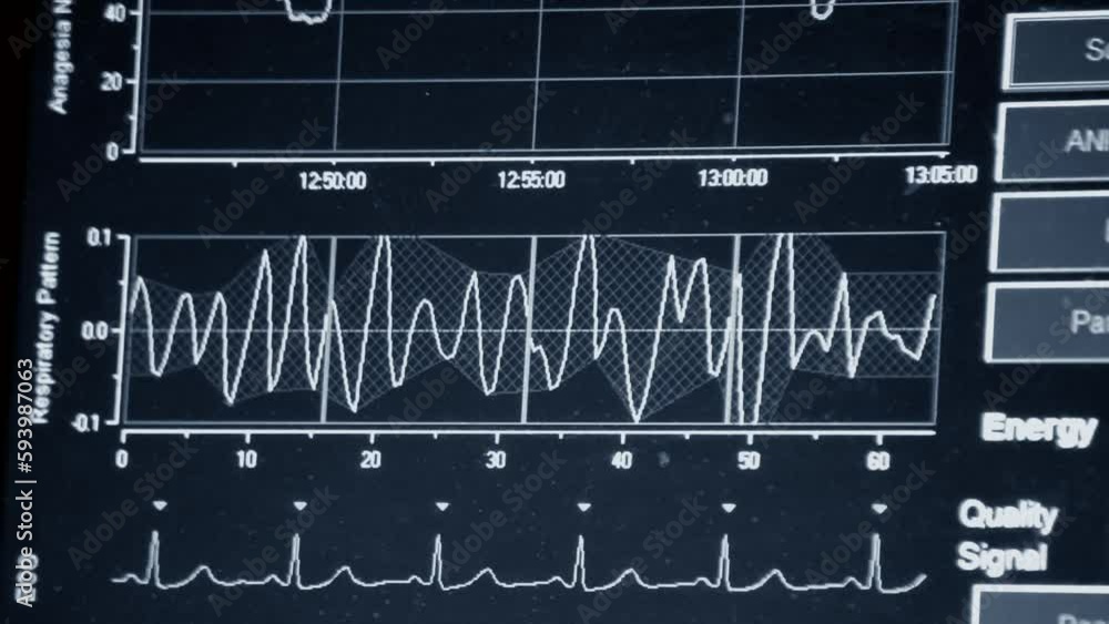 Vidéo Stock Modern patient monitor. Electronic Health Monitor displaying medical indicators and ...