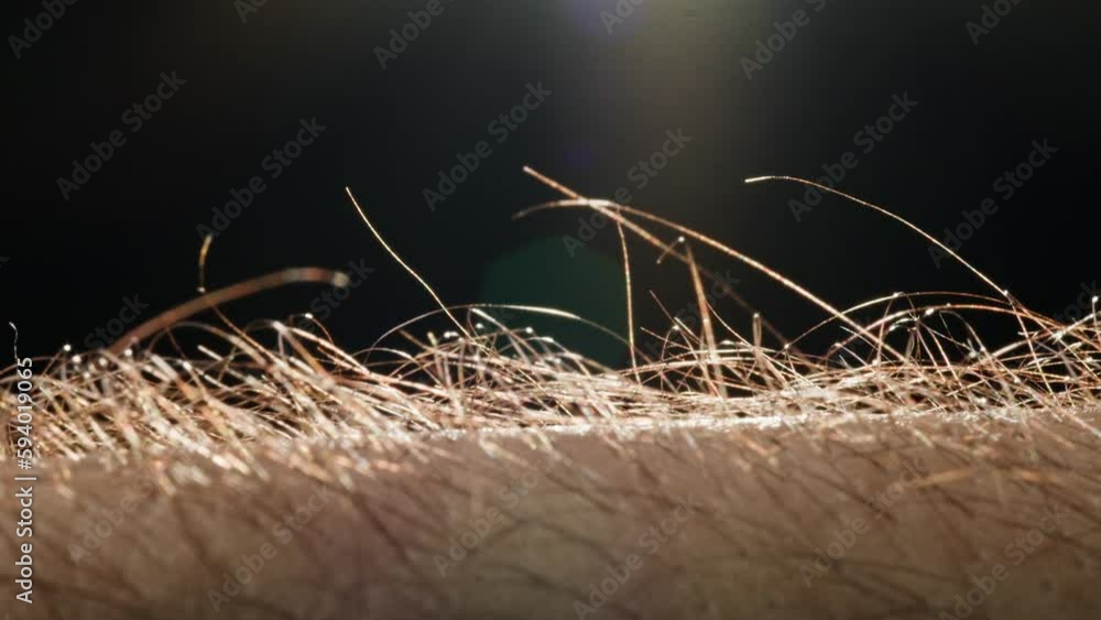 Hand skin texture hair goosebumps close-up. Hairy goose bumps Arm ...