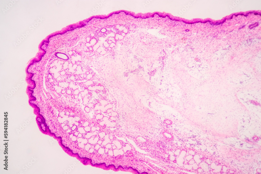 Anatomy and Histological Bone, Elastic cartilage human and Joint of ...