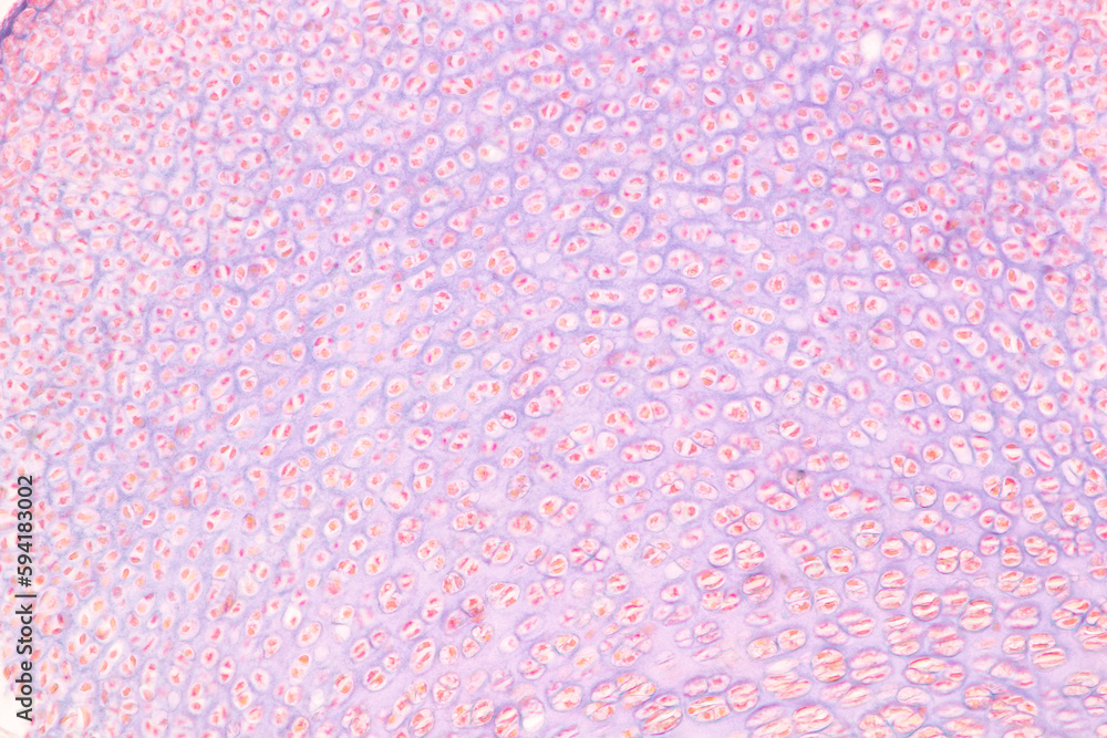 Poster Anatomy and Histological Bone, Elastic cartilage human and Joint ...