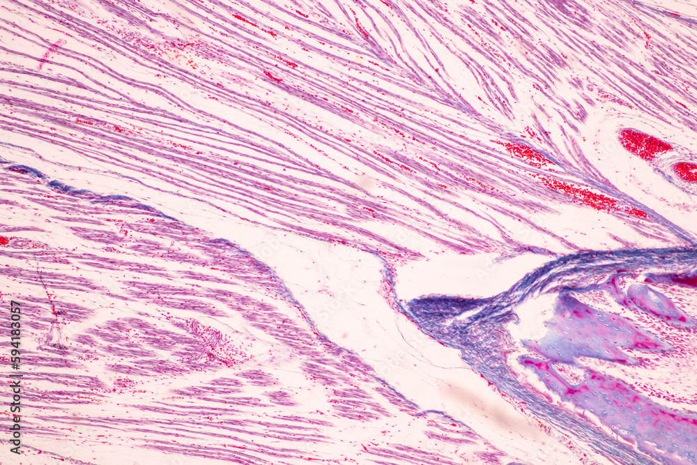 Anatomy and Histological Bone, Elastic cartilage human and Joint of ...
