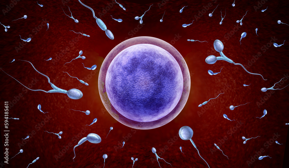 Sperm disorder and Male Infertility and reproduction concept as ...