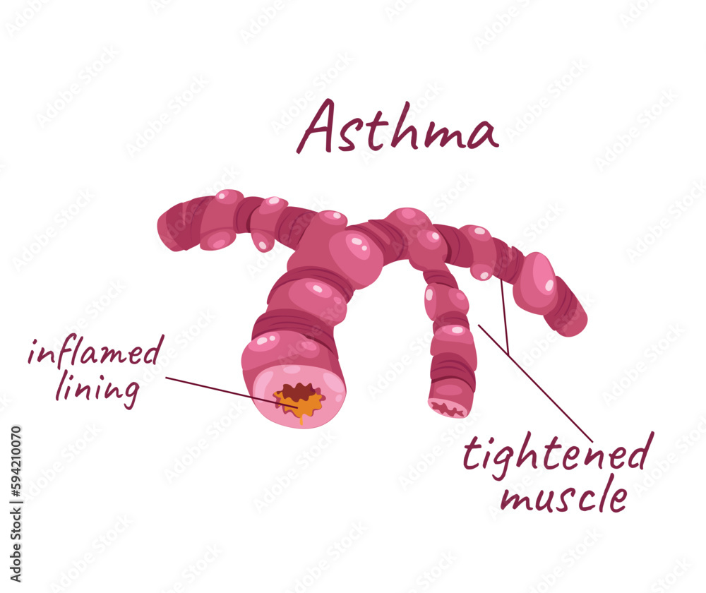 Concept Human anatomy organ lungs. The illustration is a flat, vector ...