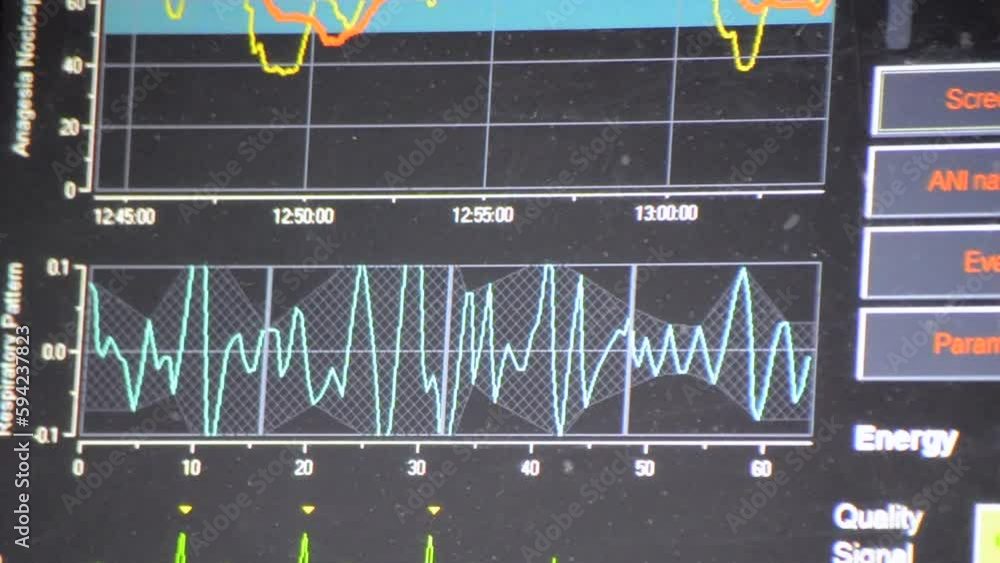 Modern patient monitor. Electronic Health Monitor displaying medical ...