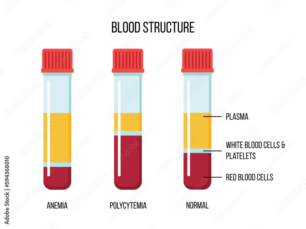 The Composition of Blood poster. Red blood cells, white blood cells ...