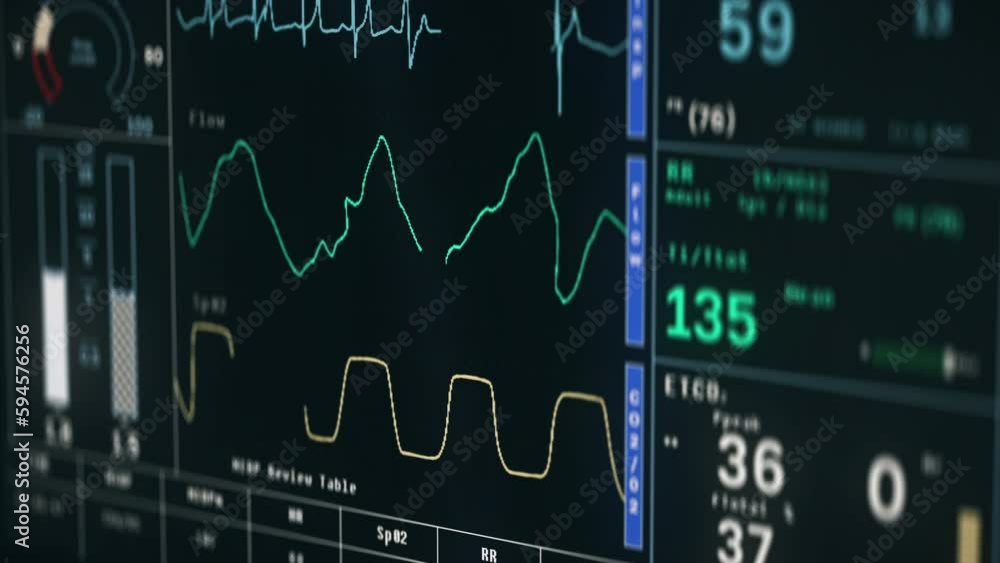 Diagnostic screen monitoring the life signs of the patient at the ...