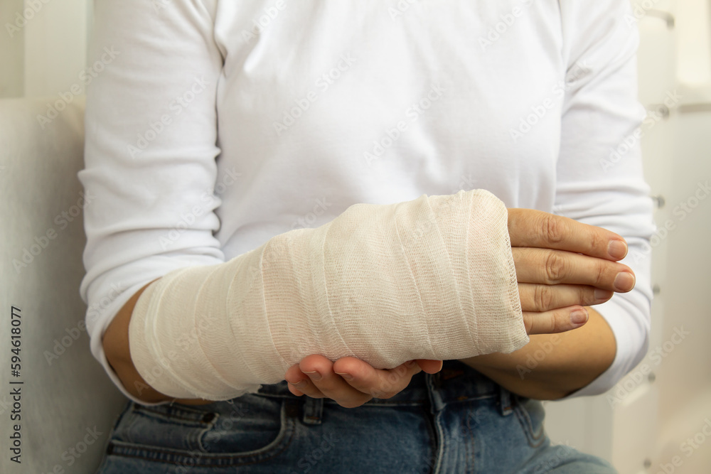 Close-up of a broken arm of a woman in a cast in a white t-shirt on a ...