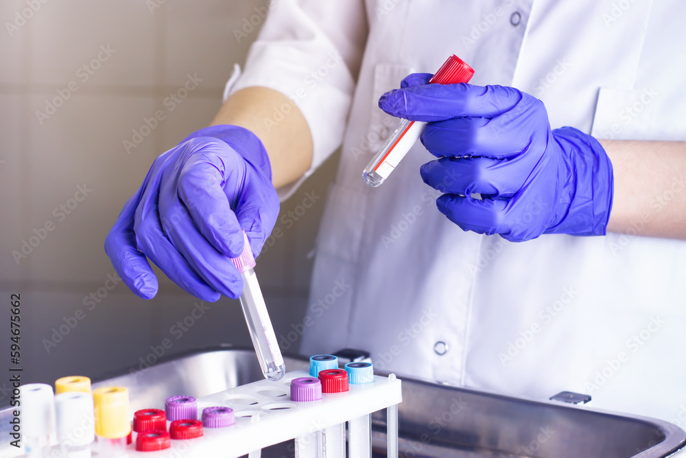 hands of a laboratory assistant with a blood sample and fortitude with ...