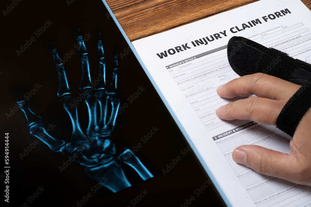 X-ray film and a man with wrapped hand on a work injury claim form ...