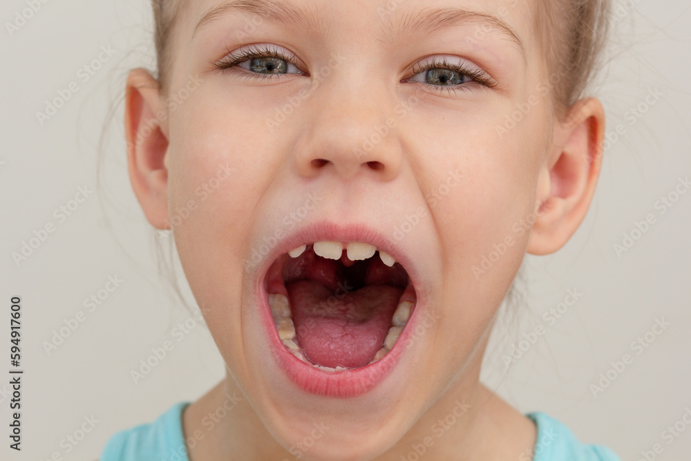 Child face with wide opened mouth cropped head caucasian little girl of ...
