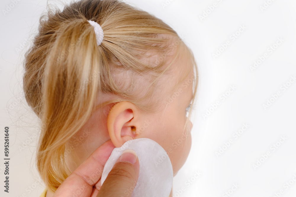 ear small patient, child, girl 3 years old, part face profile close-up ...
