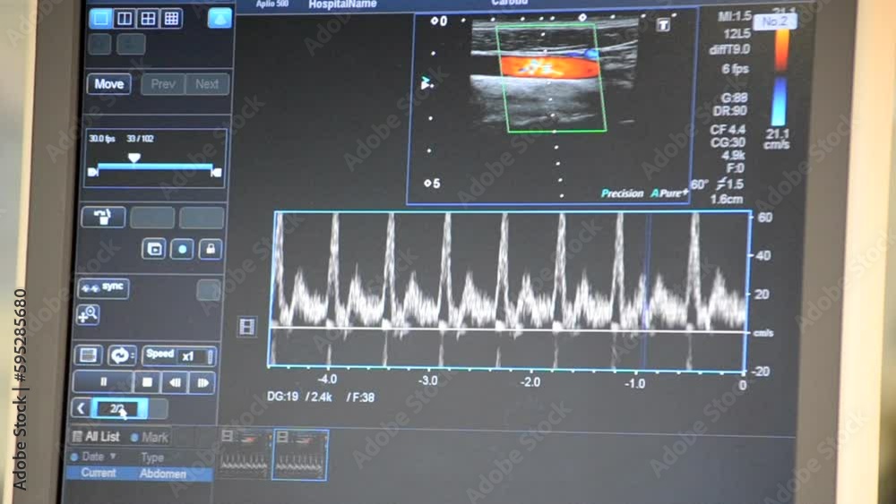 Modern patient monitor. Electronic Health Monitor displaying medical ...