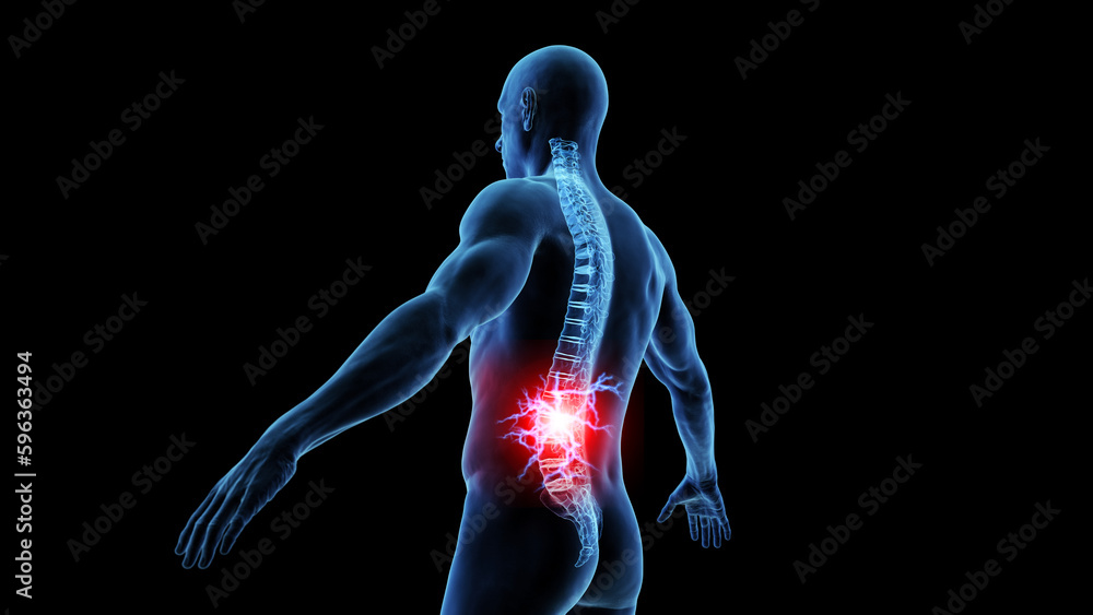 3d medical illustration of lower back pain Stock Illustration | Adobe Stock
