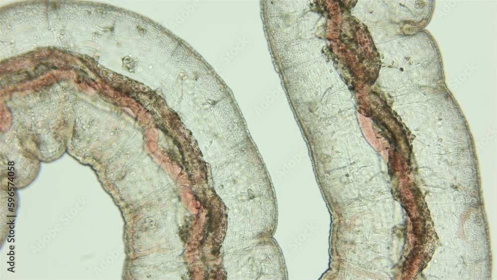 Worm from family Naididae under a microscope, possibly Tubifex. Found ...