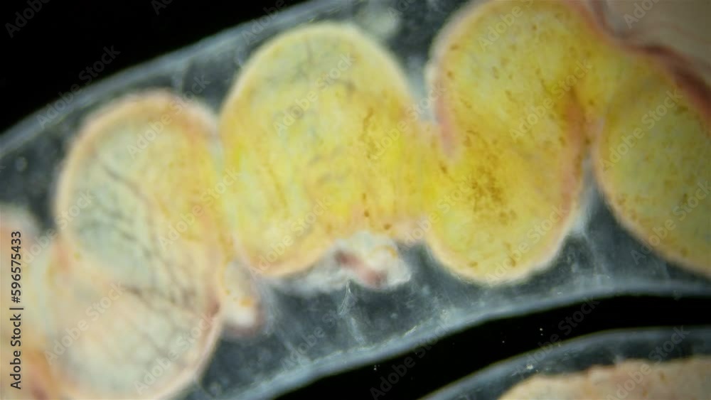 Worm from family Naididae under a microscope, possibly Tubifex. Found ...