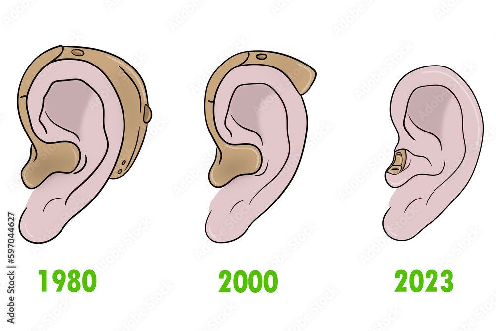 Evolution of cochlear implant through the years. From big to small ...