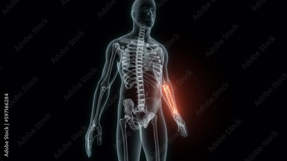 3D rendering of a medical animation of a Forearm. X-ray of a human ...