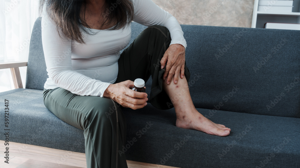Mature Asian woman scratching her dermatitis feet while sitting on sofa ...