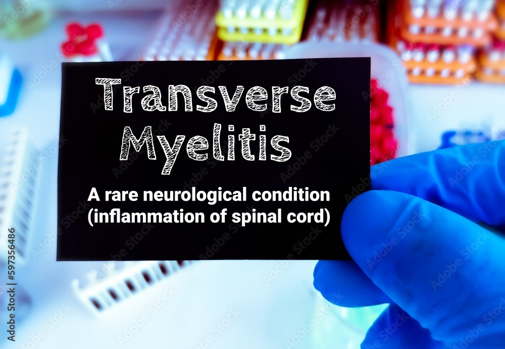 Poster transverse myelitis, a rare neurological condition of the ...