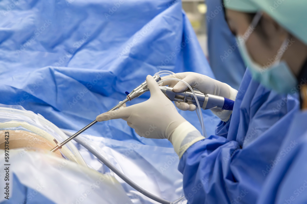 Team of doctor or surgeon and nurse in blue gown inside operating room ...