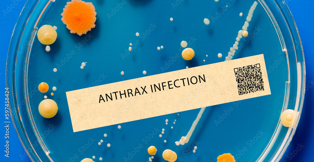 Anthrax - Bacterial infection that can cause skin, lung, and ...