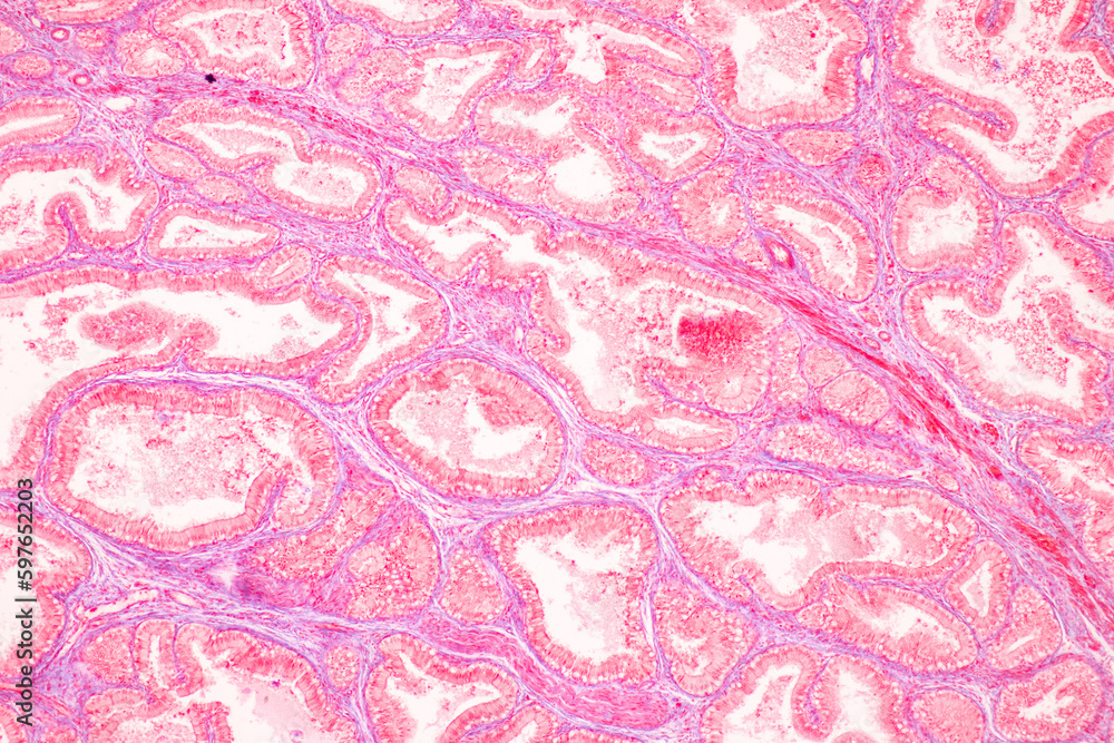 Histological Spermatic cord human, Seminal vesicle human, Prostate ...