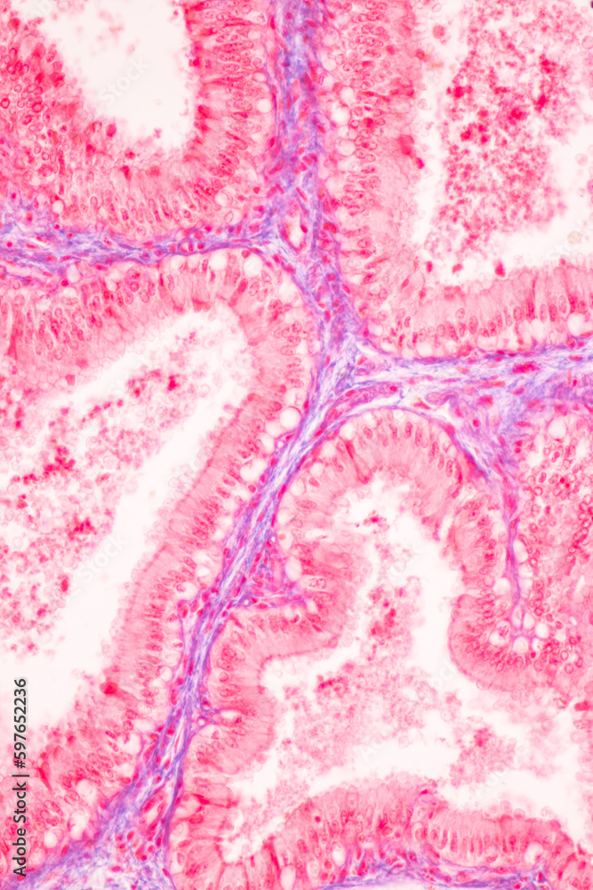 Histological Spermatic cord human, Seminal vesicle human, Prostate ...