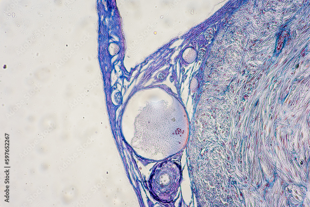 Histological Spermatic cord human, Seminal vesicle human, Prostate ...
