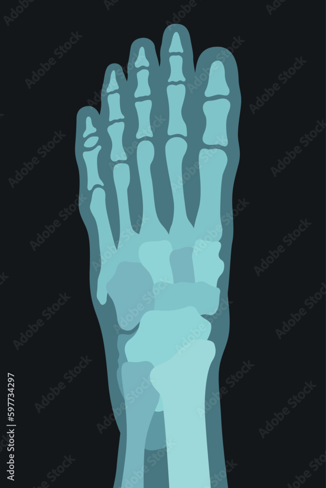 X ray image of human foot top view transparent silhouette bone anatomy ...