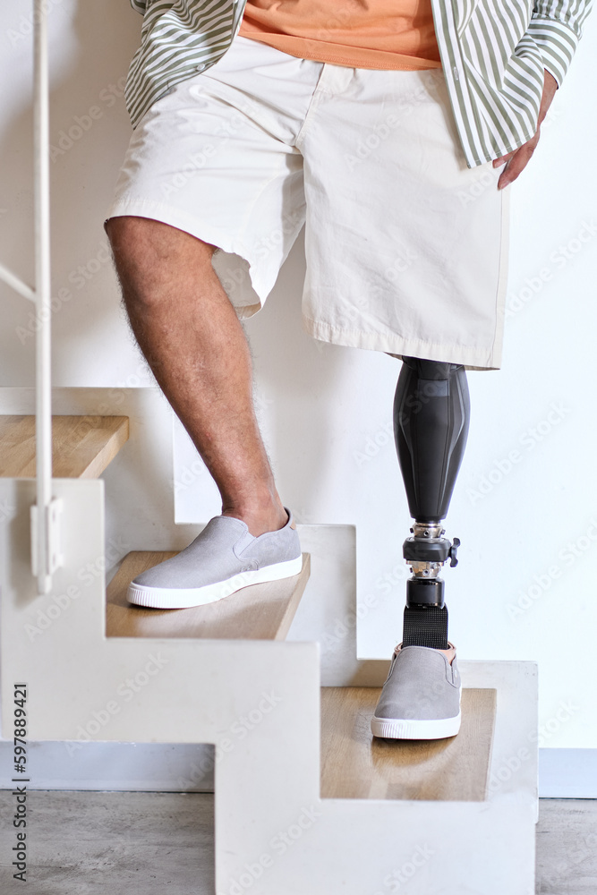 Man amputee with prosthetic leg disability on above knee transfemoral ...