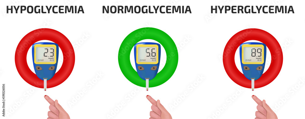 A concept for measuring mmol-l blood glucose levels. Low blood glucose ...