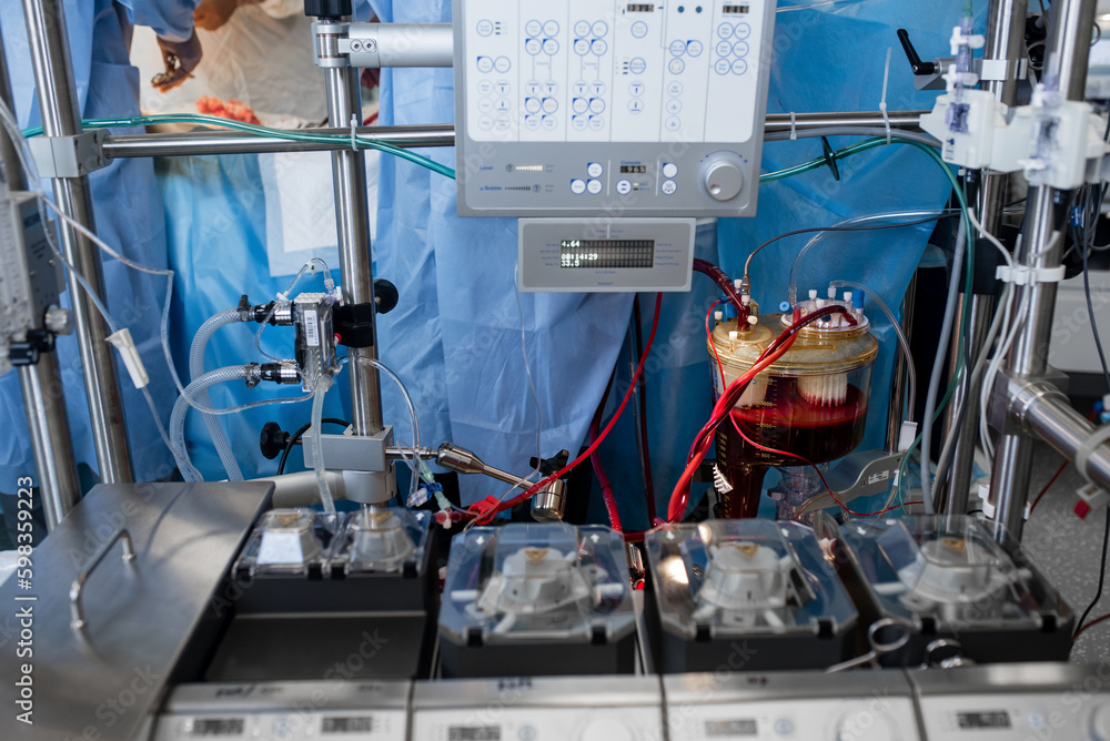 Heart lung machine for heart surgery in operating room. Apparatus ...