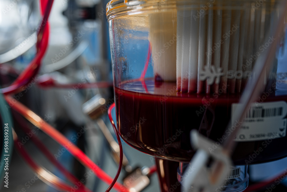 Bypass circulation unit an artificial as a for heart surgery in ...