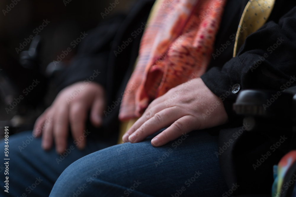 Wearing a colorful scarf and a yellow tie, a disabled transman in his ...